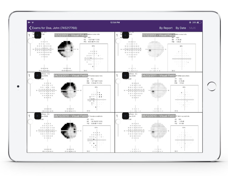 5 Must-Have Ophthalmology Image Management Software Features